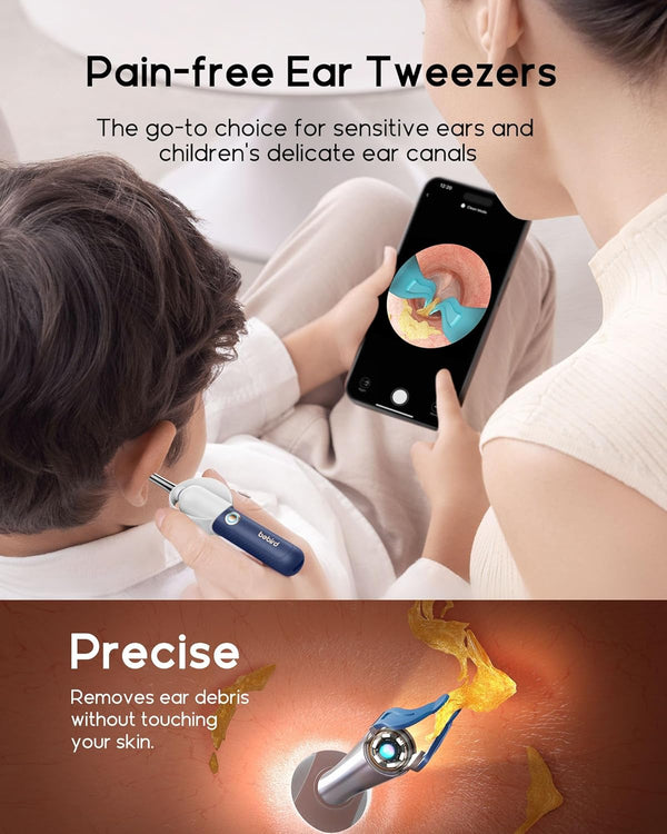 🦻 Smart Wireless HD Ear Cleaning Endoscope – The Most Advanced & Painl ...