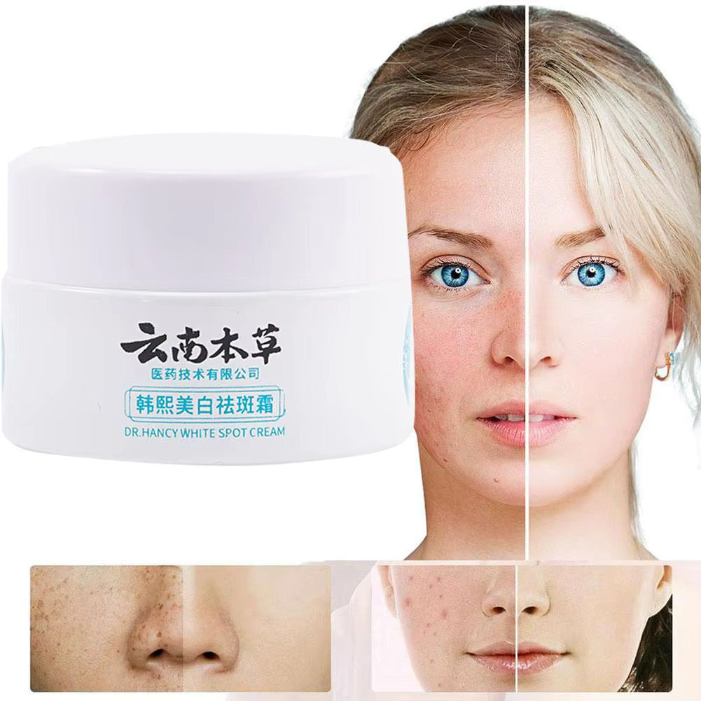 Ultimate Whitening Spot Cream – The Secret to Radiant, Even-Toned Sk ...